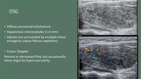Imaging Of Thyroid Pptx