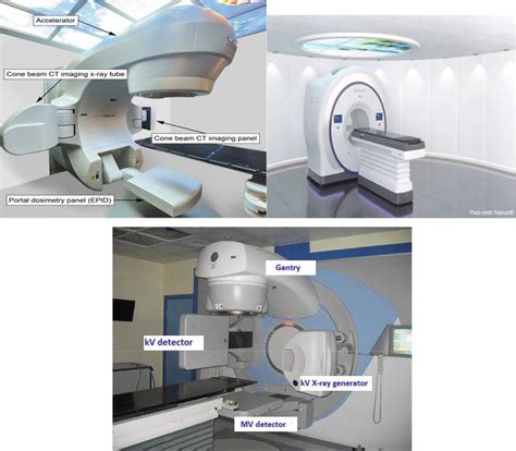 Cone Beam Radiation Treatment Cancer The Best Picture Of Beam