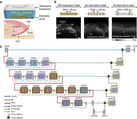 The Overview Of Deep Learning Assisted Sparse Array Periodontal