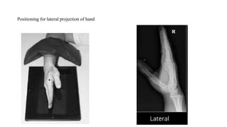 Radiographic Technique Used In X Rays Pptx