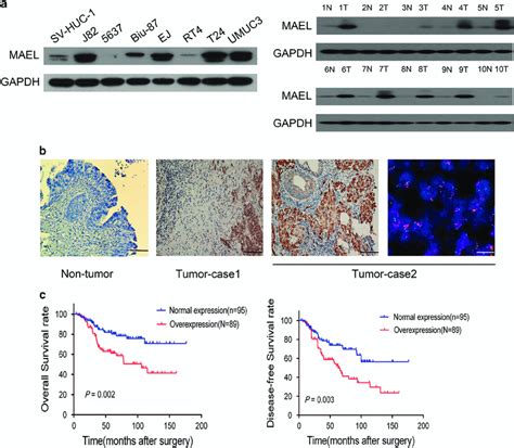 Expression And Amplification Of Mael In Ucb Cell Lines And Bladder