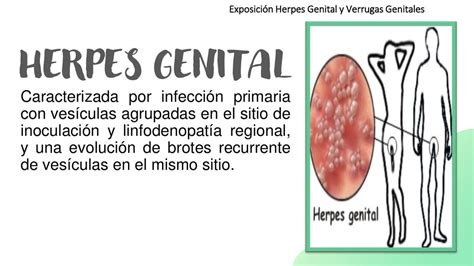 Guía Completa Herpes En El Pene Causas Síntomas Y Cómo Curar Sjsf