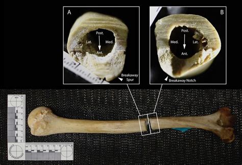 Left Humerus Posterior View Inset A Proximal Kerf Wall Inset B