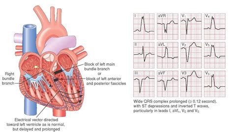 Normal 12 Lead Ecg Labeled