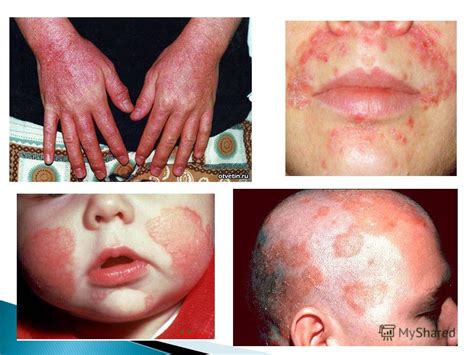 Презентация на тему Разработала учитель биологии экологии МБОУ лицея 90 г Краснодара Брезгина