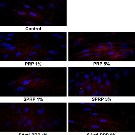 The Effect Of Different Concentrations Of Prp Sprp And Sacti Prp On Download Scientific