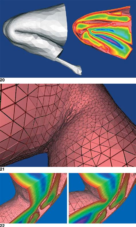 Figure 1 From An Improved Finite Element Contact Model For Anatomical