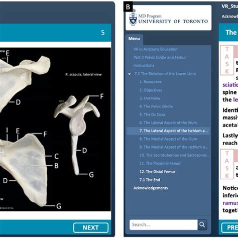 Example From The Upper Limb A And Lower Limb B Anatomy Modules Download Scientific Diagram