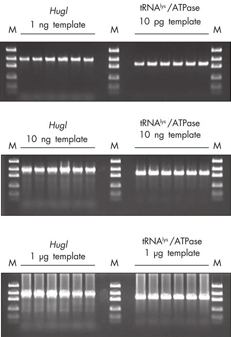 FlexiGene DNA Kit