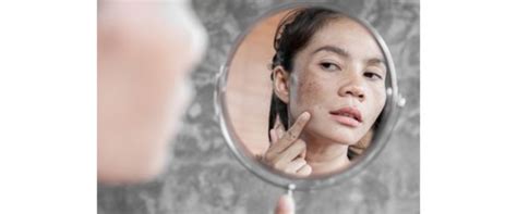 Bukan Pakai Susu Ini Trik Agar Kulit Bebas Spot Gelap Pakai Jenis Kulit Buah