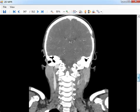 dicom view dicom multiplanar reconstruction in winforms