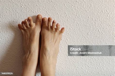 Subungual 혈종이있는 여성 발 외상으로 인한 검은 발톱 곰팡이 감염 화학 요법 손발톱 진균증 발톱의 황변을 일으키는 곰팡이 감염으로 고통받는 사람 복사 공간 건강