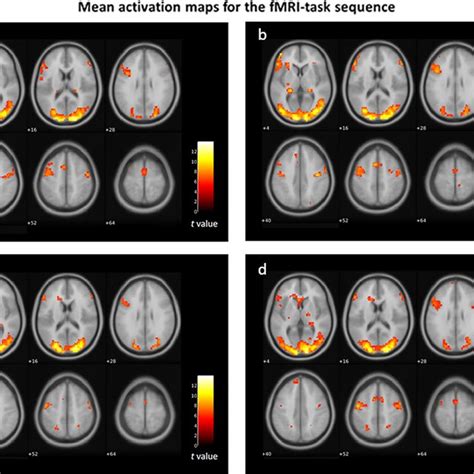 Plots For The Quality Metrics For Resting State Functional Mri