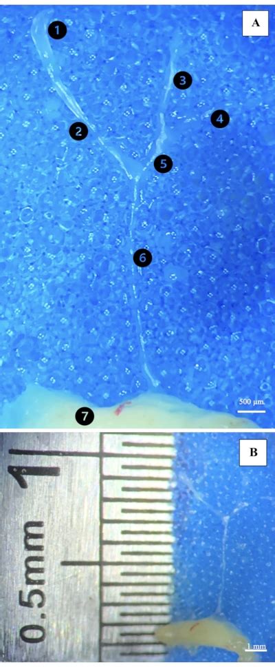Dokuz Günlük Fare Yenidoğanlarında Ekstrahepatik Safra Kanalı Ve Safra