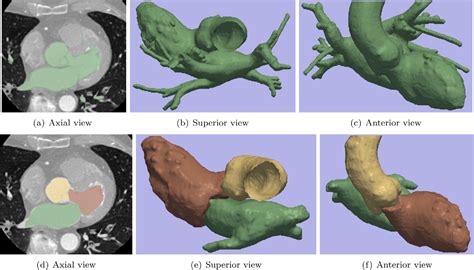 Figure 1 From A 3d Interactive Multi Object Segmentation Tool Using