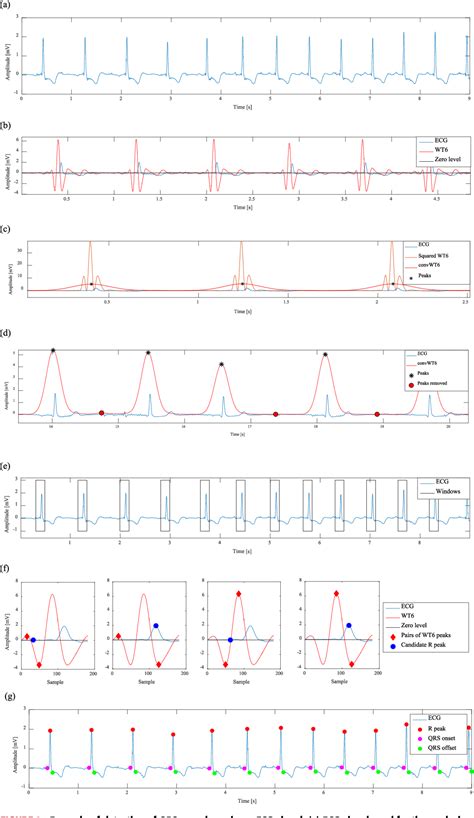 Figure 2 From A New Wavelet Based Ecg Delineator For The Evaluation Of The Ventricular
