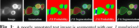Figure 1 From J Regularization Improves Imbalanced Multiclass Segmentation Semantic Scholar