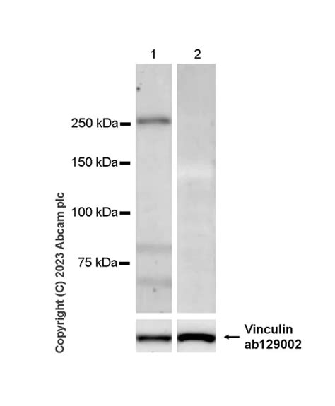 Anti Otoferlin Antibody Epr28223 1 Ab309197 Abcam