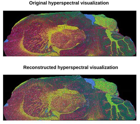 Computational Method Provides Faster High Resolution Mass Spectrometry Imaging Cancer Center