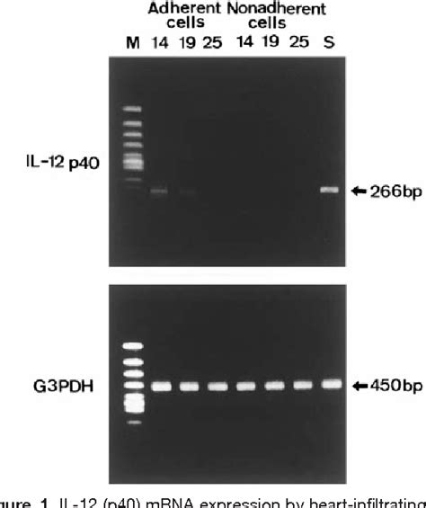 Figure 1 From Recombinant Murine Interleukin 12 Facilitates Induction Of Cardiac Myosin Specific