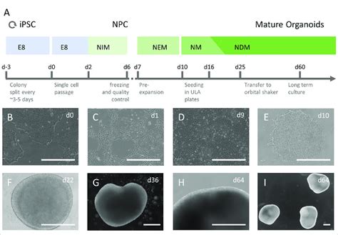 Culture Of Ipsc Derived Human Brain Organoids A Ipscs Were Cultured Download Scientific