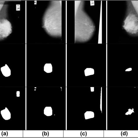 Automated Mammogram Breast Cancer Detection Using The Optimized
