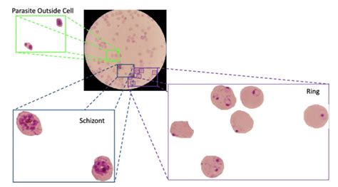 Avishek1111malaria Parasite Detection At Main