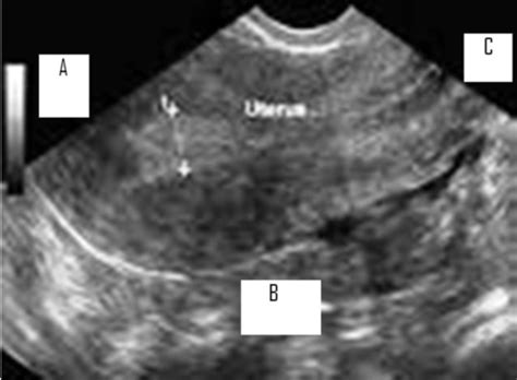 OB 1 FINAL Flashcards Quizlet
