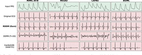 Region Disentangled Diffusion Model For High Fidelity Ppg To Ecg Translation Paper And Code