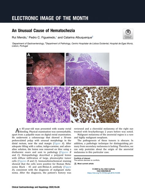 Pdf An Unusual Cause Of Hematochezia