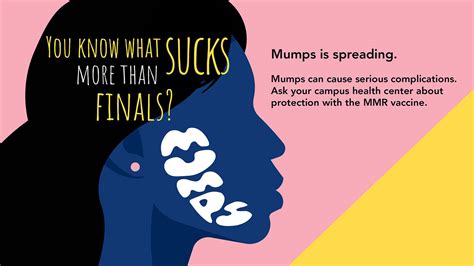 Mumps Social Media Graphics Mumps Cdc