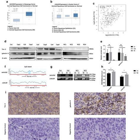 The Expression Of Tim 3 And Galectin 9 In Cervical Cancer Tissues And Download Scientific