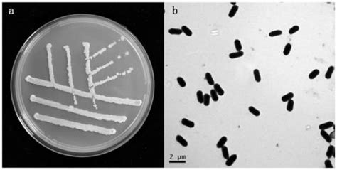 Bacillus Velezensis And Application Thereof Eureka Patsnap