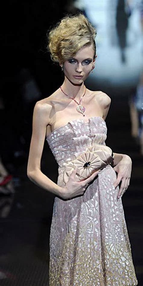 Georgiainfonews Most Skinny Celebrities 21 Pics