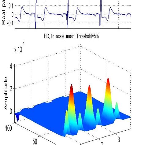 Time And 3d Time Frequency Representations Of The Normal Ecg Signal Download Scientific Diagram
