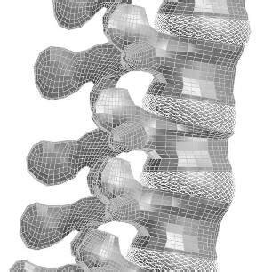 Finite Element Model Of The Intact Spine Left And The Fractured Spine Download Scientific