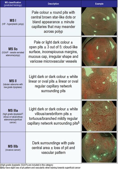 Modified Sano Classification Adapted From Pu Et Al⁹ Download