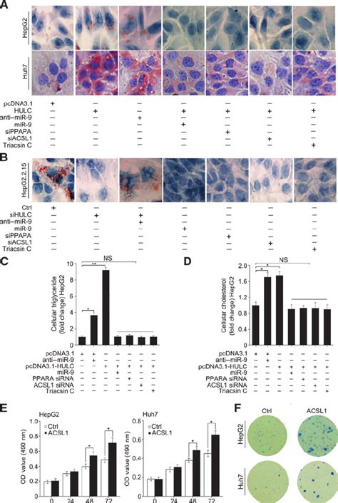 Hulc Disrupts The Lipid Metabolism Of Hepatoma Cells Through Mir 9 Download Scientific Diagram