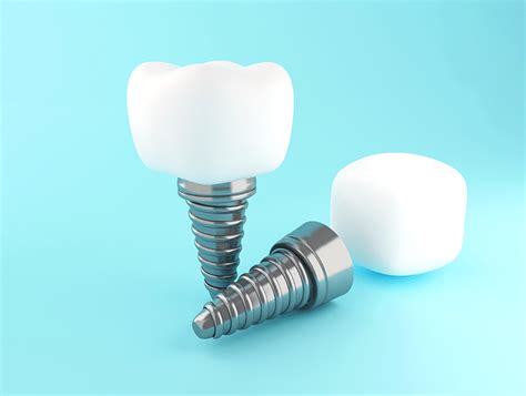 Appointments Richmond Hill Smile Centre We Customize Your Treatment