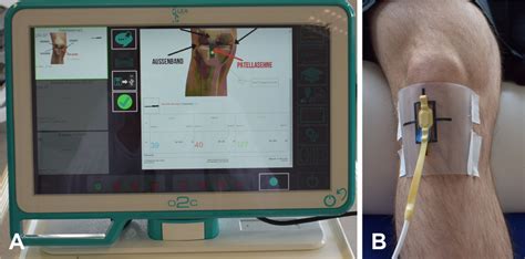 A Hardware For Microcirculation Measurement Using A Laser Doppler Download Scientific Diagram