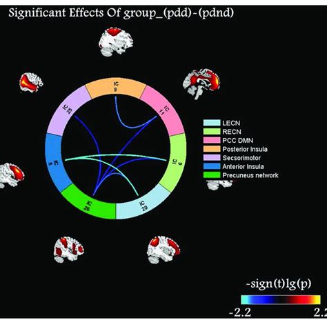 Comparisons Of Inter Network Functional Connectivity Fc Alterations Download Scientific