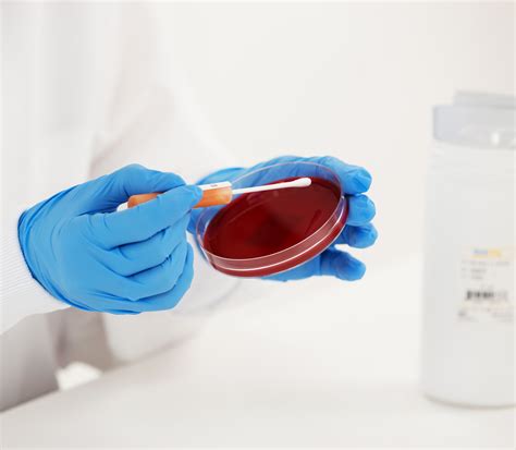 Kwik Stik Staphylococcus Aureus Subsp Aureus Atcc® 29213™ Sobioda