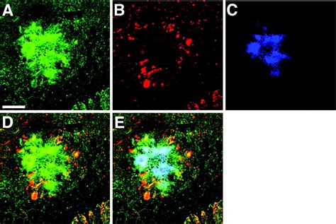 Presynaptic Localization Of Neprilysin Contributes To Efficient Clearance Of Amyloid β Peptide