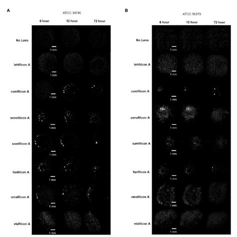 Once Aggregated Cell Counts Of Acanthamoeba Polyphaga Atcc 30461 Download Scientific Diagram