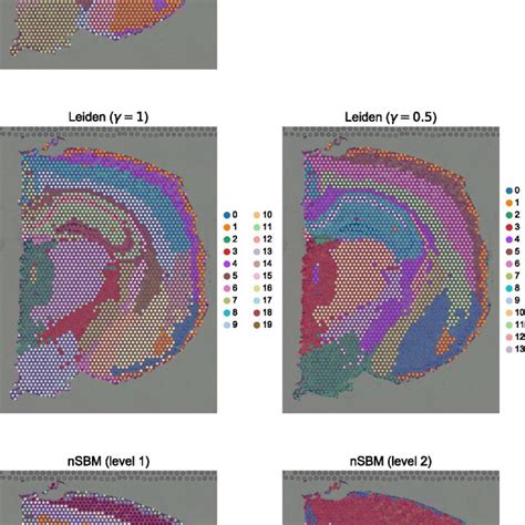 Analysis Of Spatial Transcriptomics Of A Coronal Section Of Mouse Brain