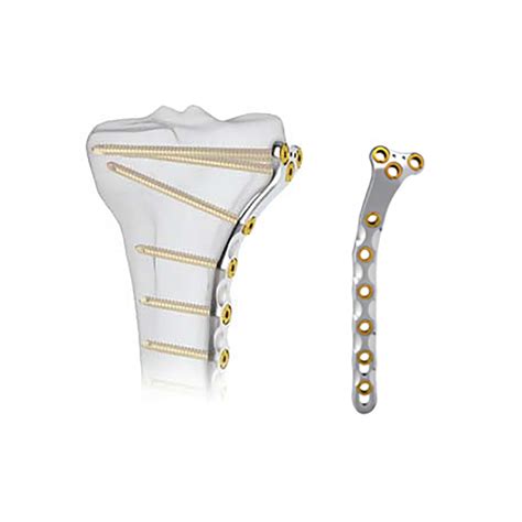 Proximal Tibia Plate Clinilab