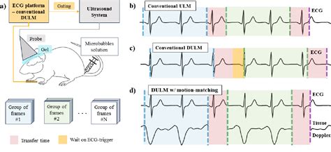 Figure 1 From Dynamic Imaging Using Any Ultrasound Localization Microscopy Dataset Semantic