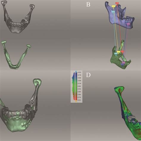 Three Dimensional Surface Matching Procedure Of The Corresponding Pre Download Scientific