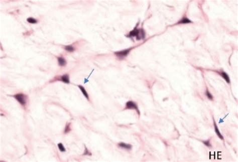 Tissus Conjonctif Cartes Quizlet