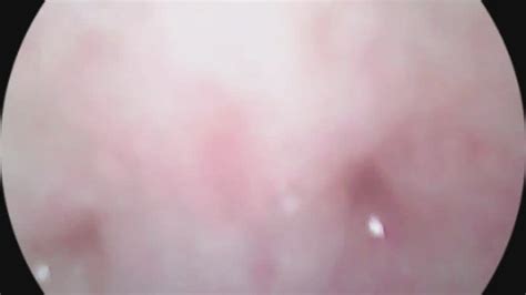 Did You See That Endoscope View Tonguegirl Clips Sale